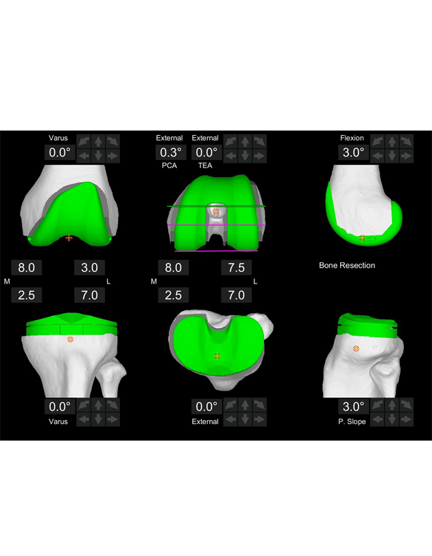 Robotic surgery - Flexclinics